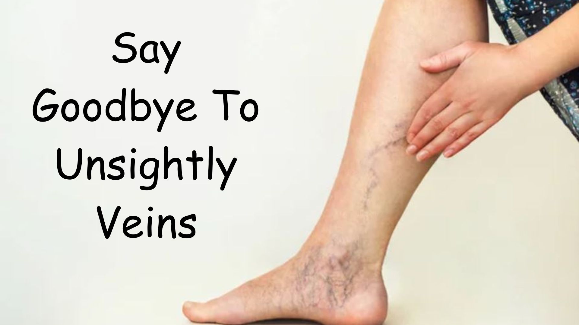 Say Goodbye To Unsightly Veins: The Best Treatments of 2024